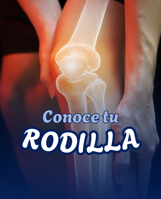 Conoce Tu Rodilla